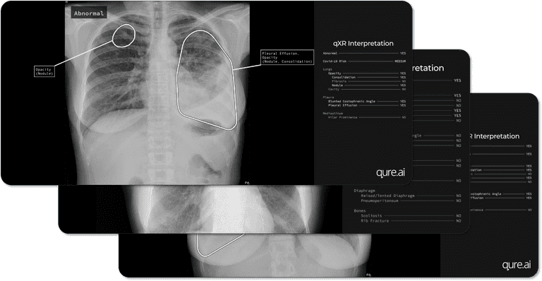 AI in Radiology: 10 Use Cases, Benefits and Examples