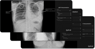 AI in Radiology: 10 Use Cases, Benefits and Examples