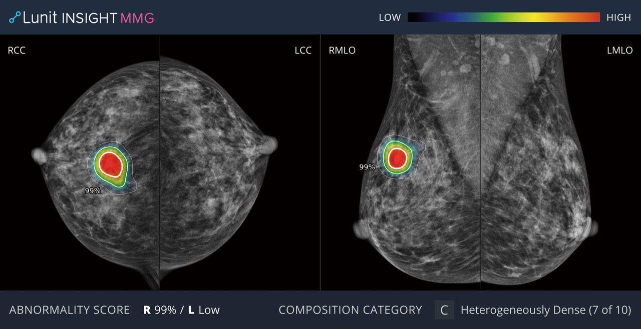 AI in Radiology: 10 Use Cases, Benefits and Examples