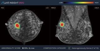 AI in Radiology: 10 Use Cases, Benefits and Examples