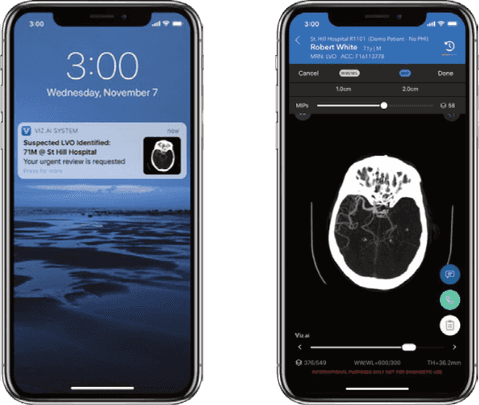AI in Radiology: 10 Use Cases, Benefits and Examples